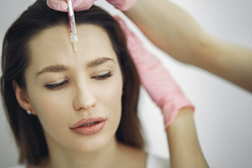 Botox Treatment: Solution for Craniofacial Hyperhidrosis